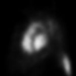 MUGA Scan – Utah Cardiology