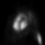 MUGA Scan – Utah Cardiology